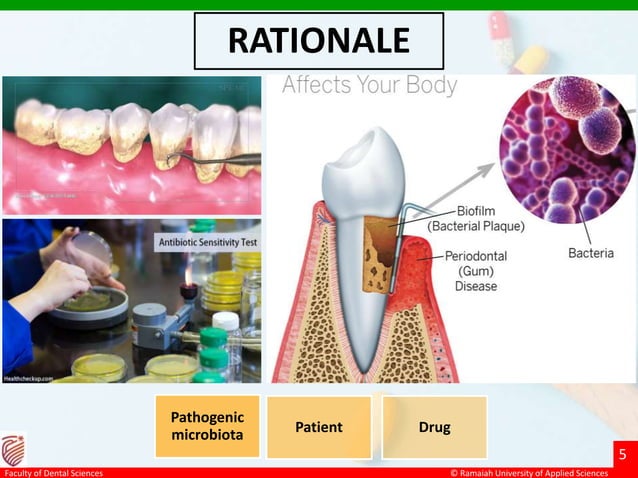 Systemic antibiotics in periodontal therapy | PPTX | Dental Health ...