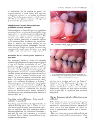Systemic antibiotics in periodontal therapyامراض اللثة د حاتم البيطار.pdf