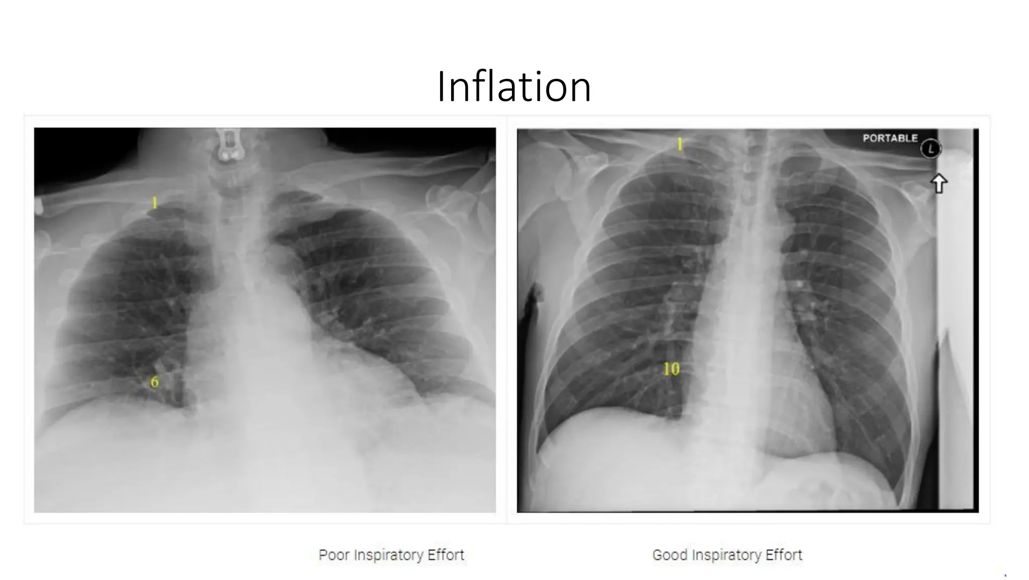 Systemic approach for reading Chest X-rays.pdf