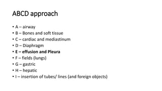 Systemic approach for reading Chest X-rays.pdf