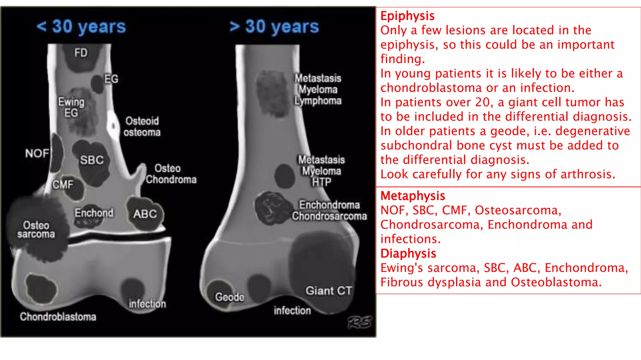 Systemic approach to bone tumor radiology | PPTX
