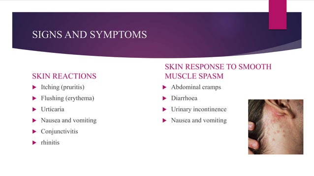 systemic complications.pptx