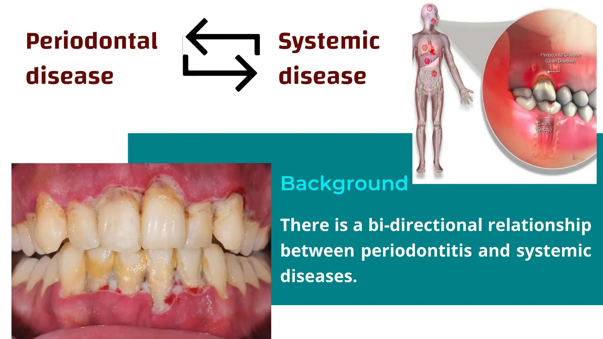 Systemic Disease And Periodontal Healthpptx