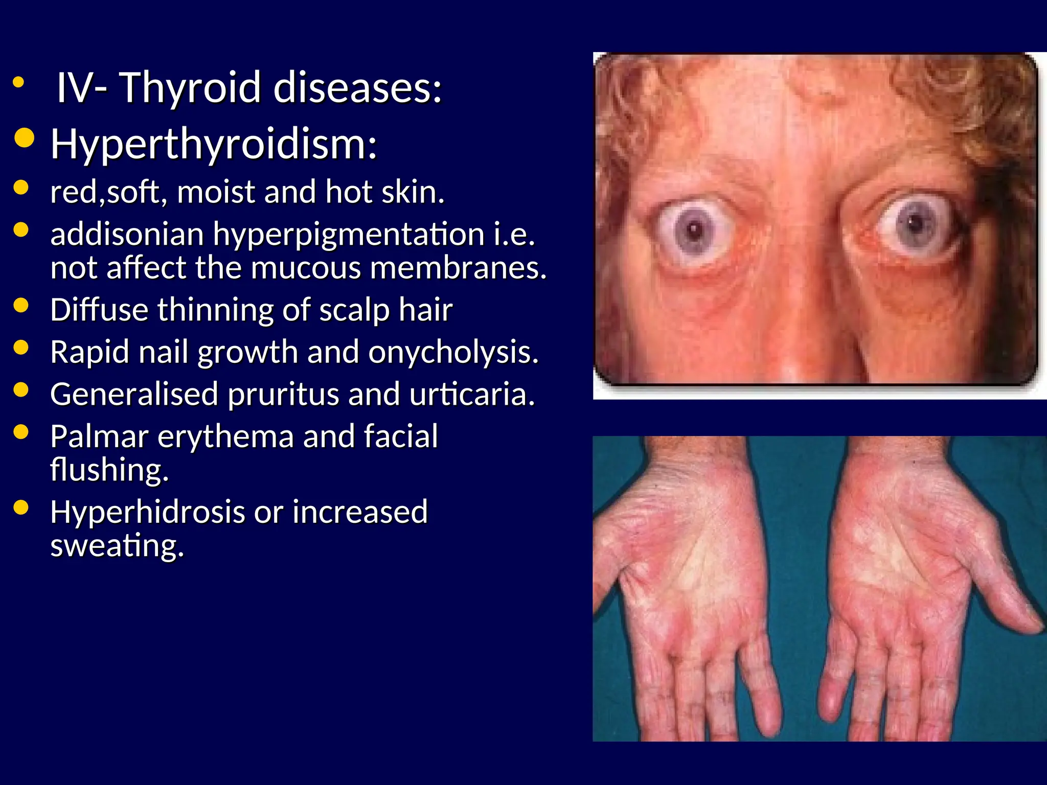 Systemic diseases - Diabetes & Cutaneous.ppt