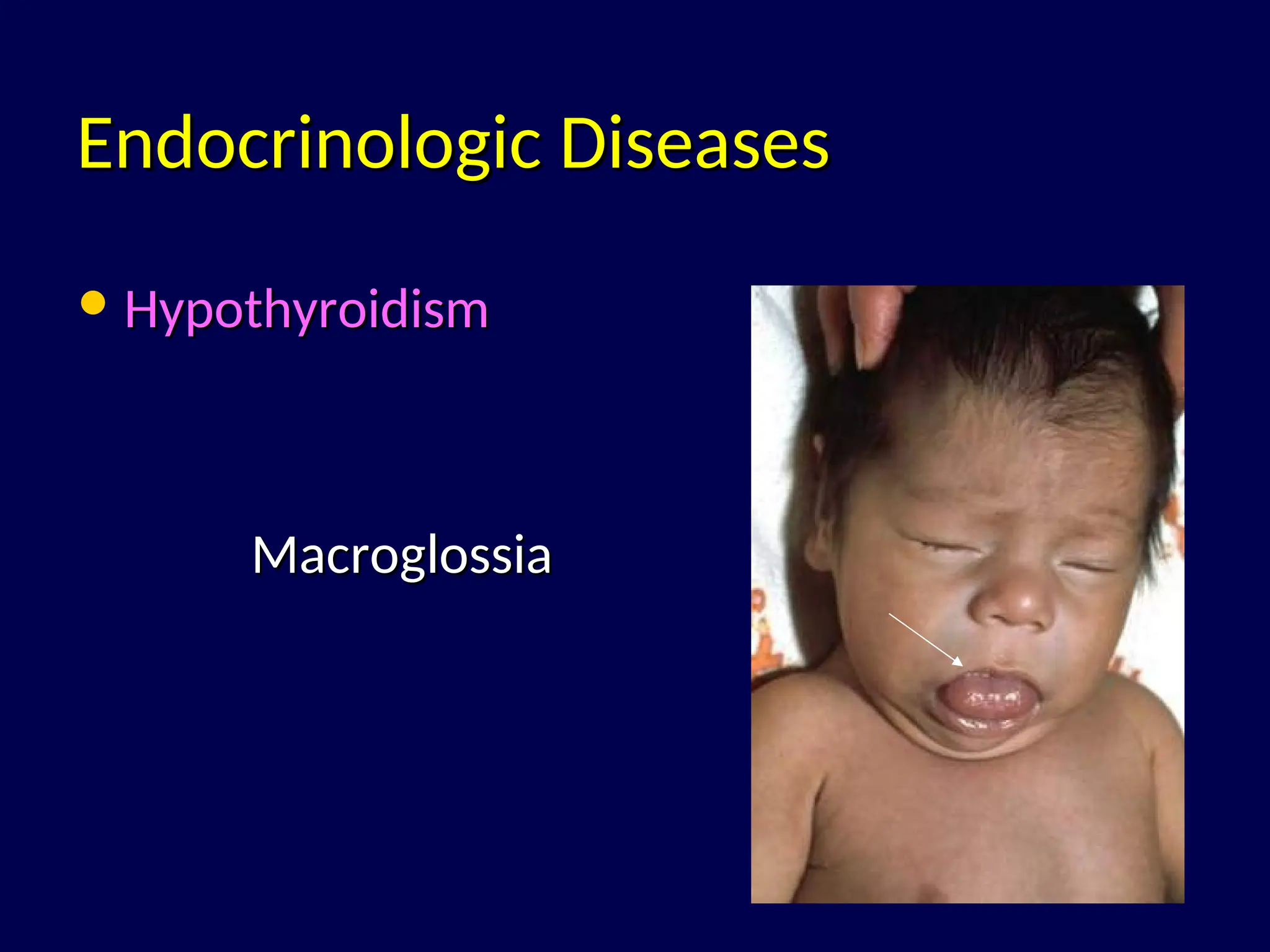 Systemic diseases - Diabetes & Cutaneous.ppt