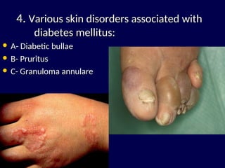 Systemic diseases - Diabetes & Cutaneous.ppt