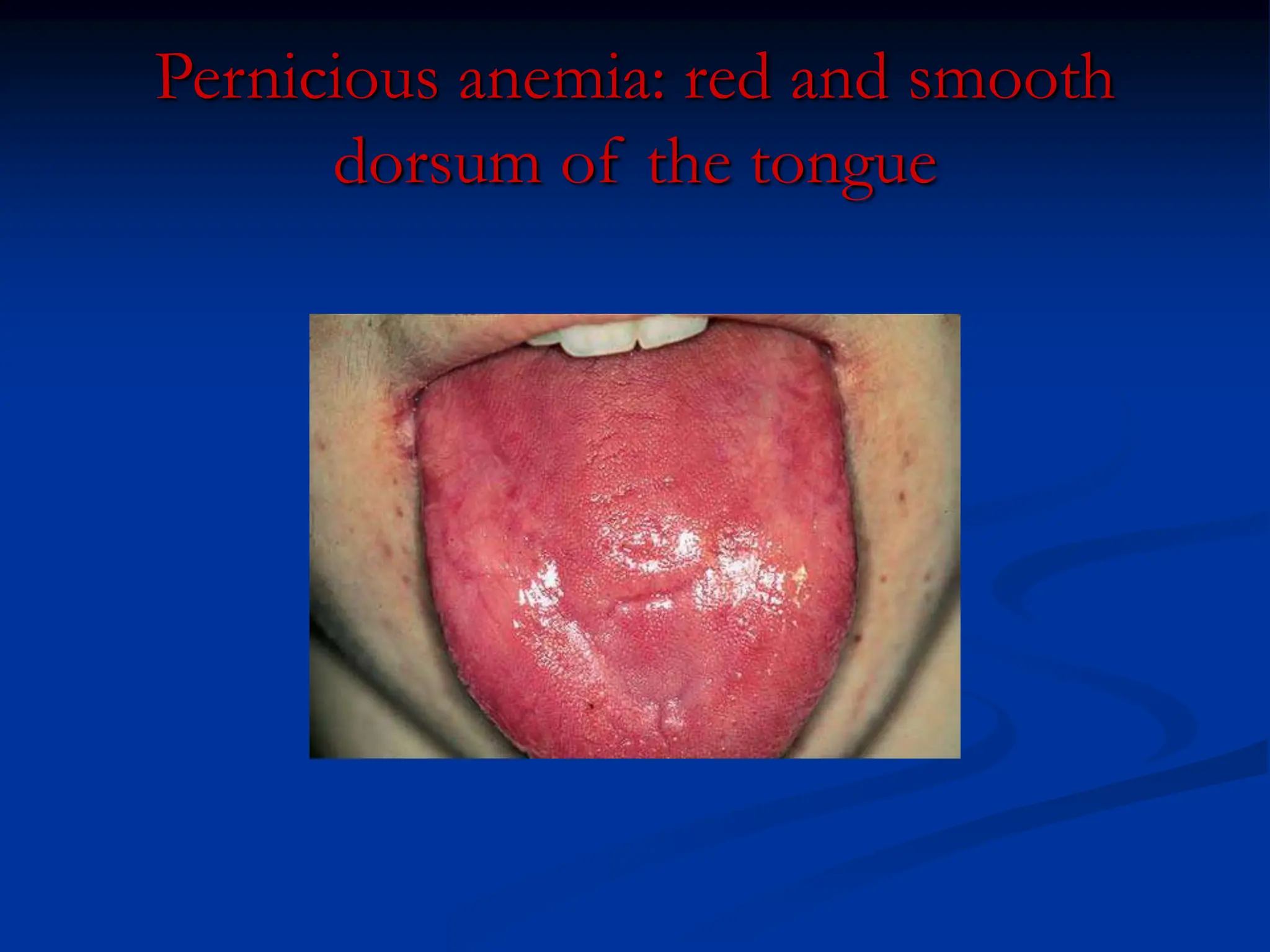 Oral manifestations of systemic diseases | PPT