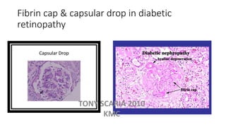 Systemic diseases associated with renal disease | PPT