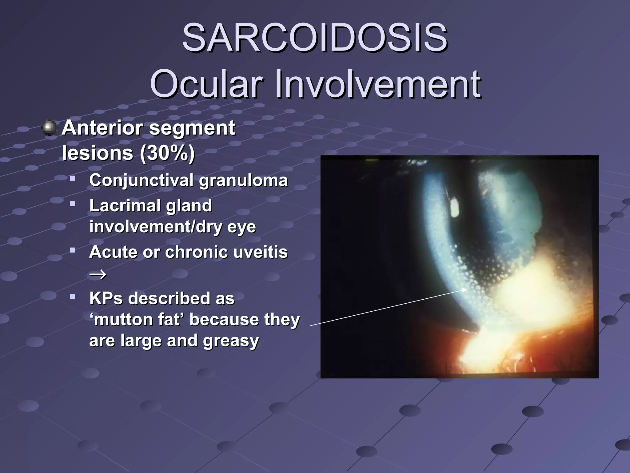 Systemic Diseases and the Eye | PPT
