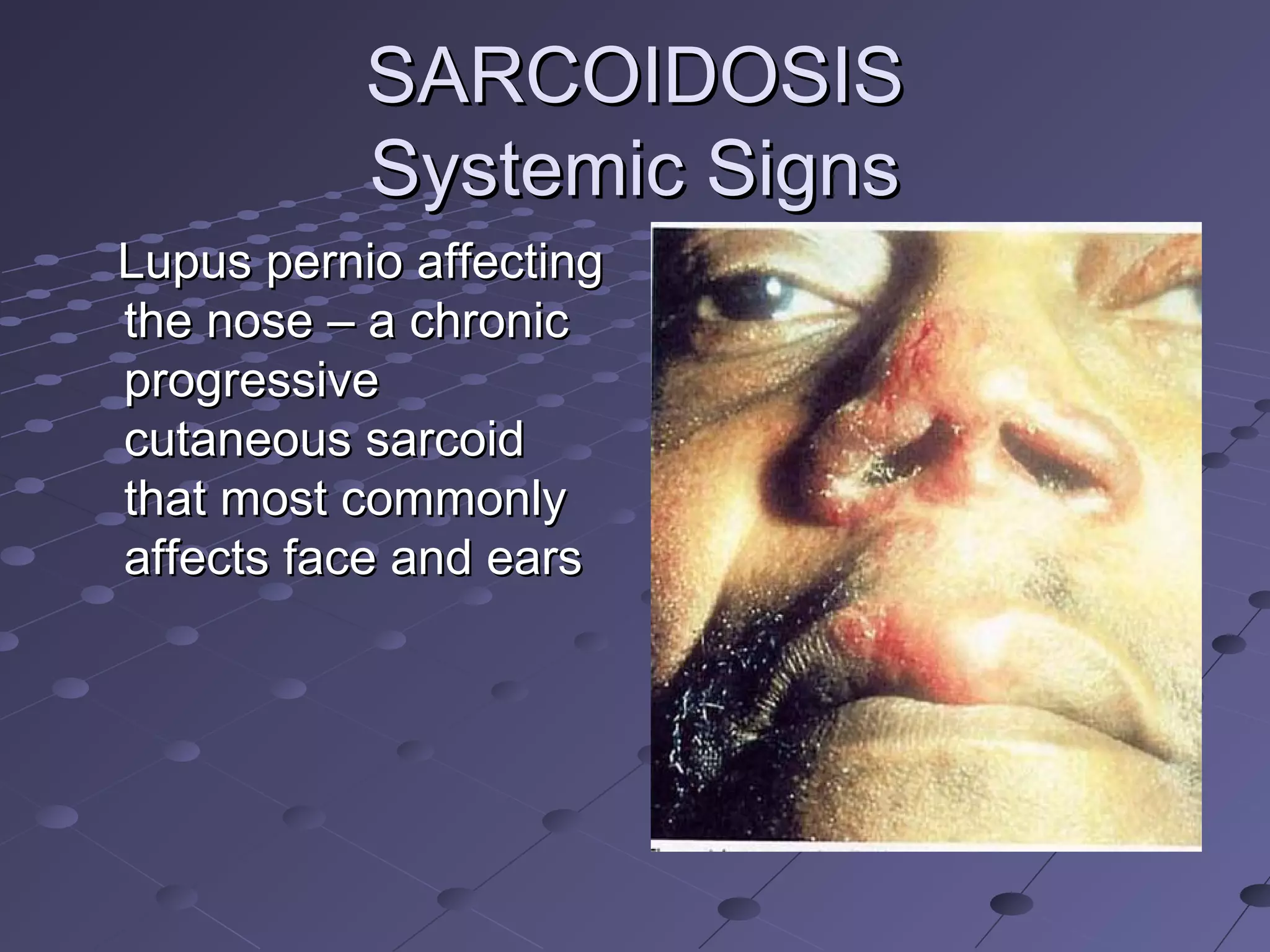Systemic Diseases and the Eye | PPT