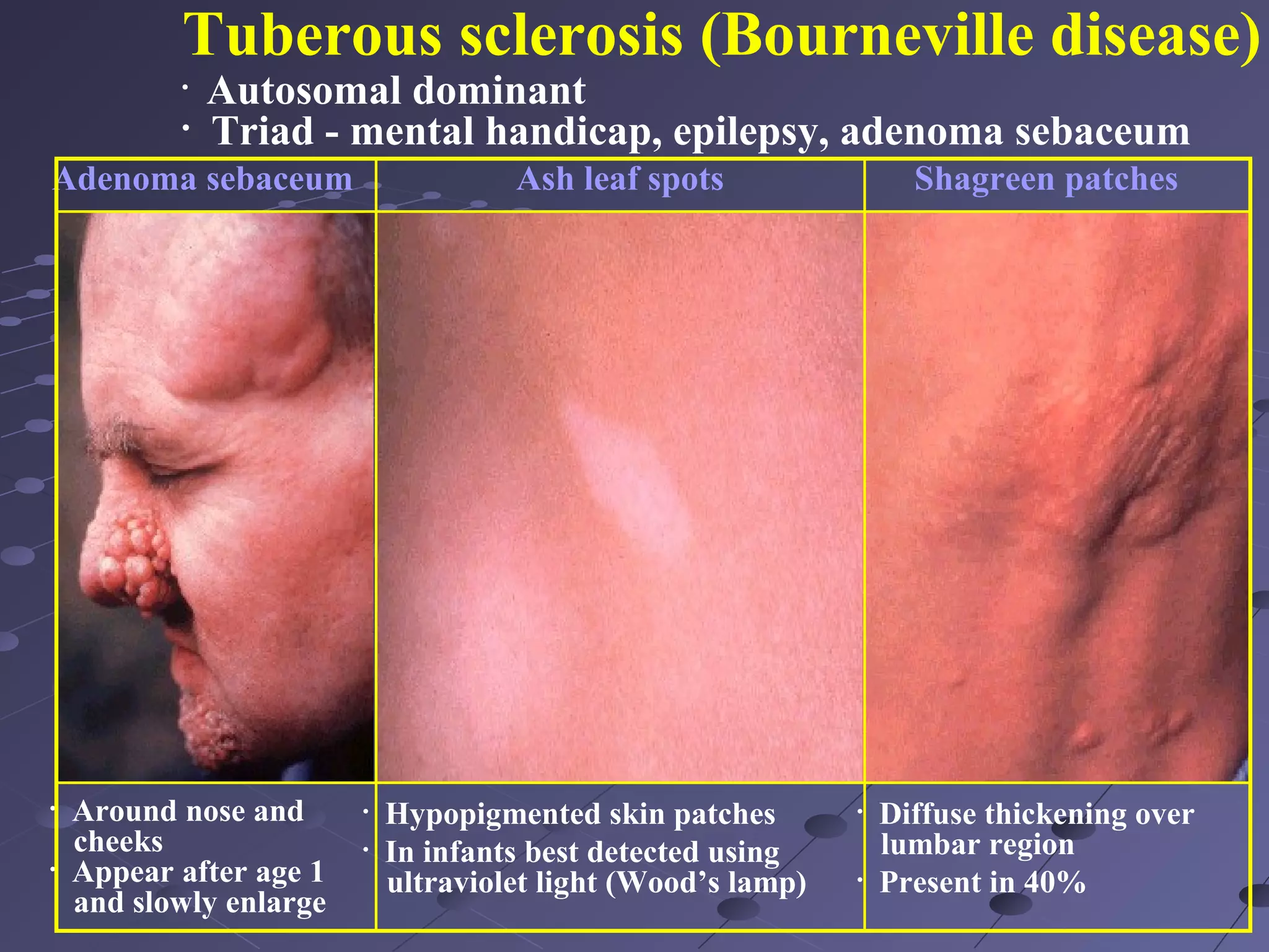 Systemic Diseases and the Eye | PPT