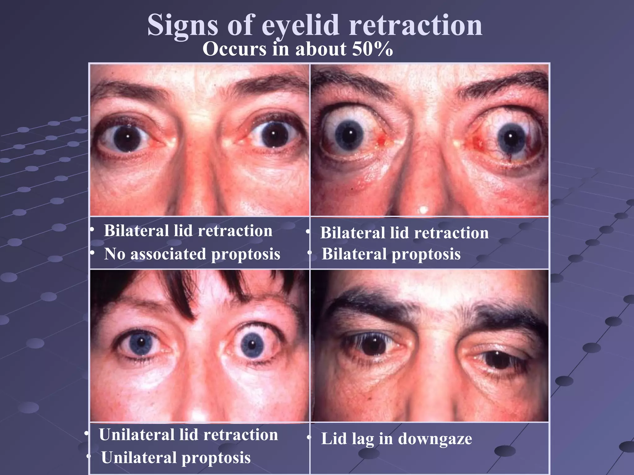 Systemic Diseases and the Eye | PPT