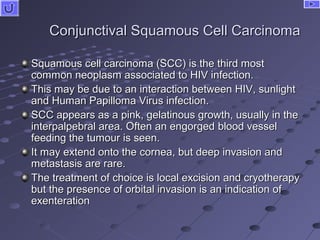 Systemic Diseases and the Eye | PPT