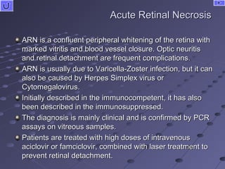 Systemic Diseases and the Eye | PPT