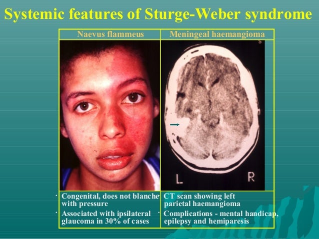 Systemic disease SR