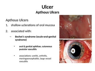Systemic Disease & Underlying Malignancy Clinical Pathology Study ...
