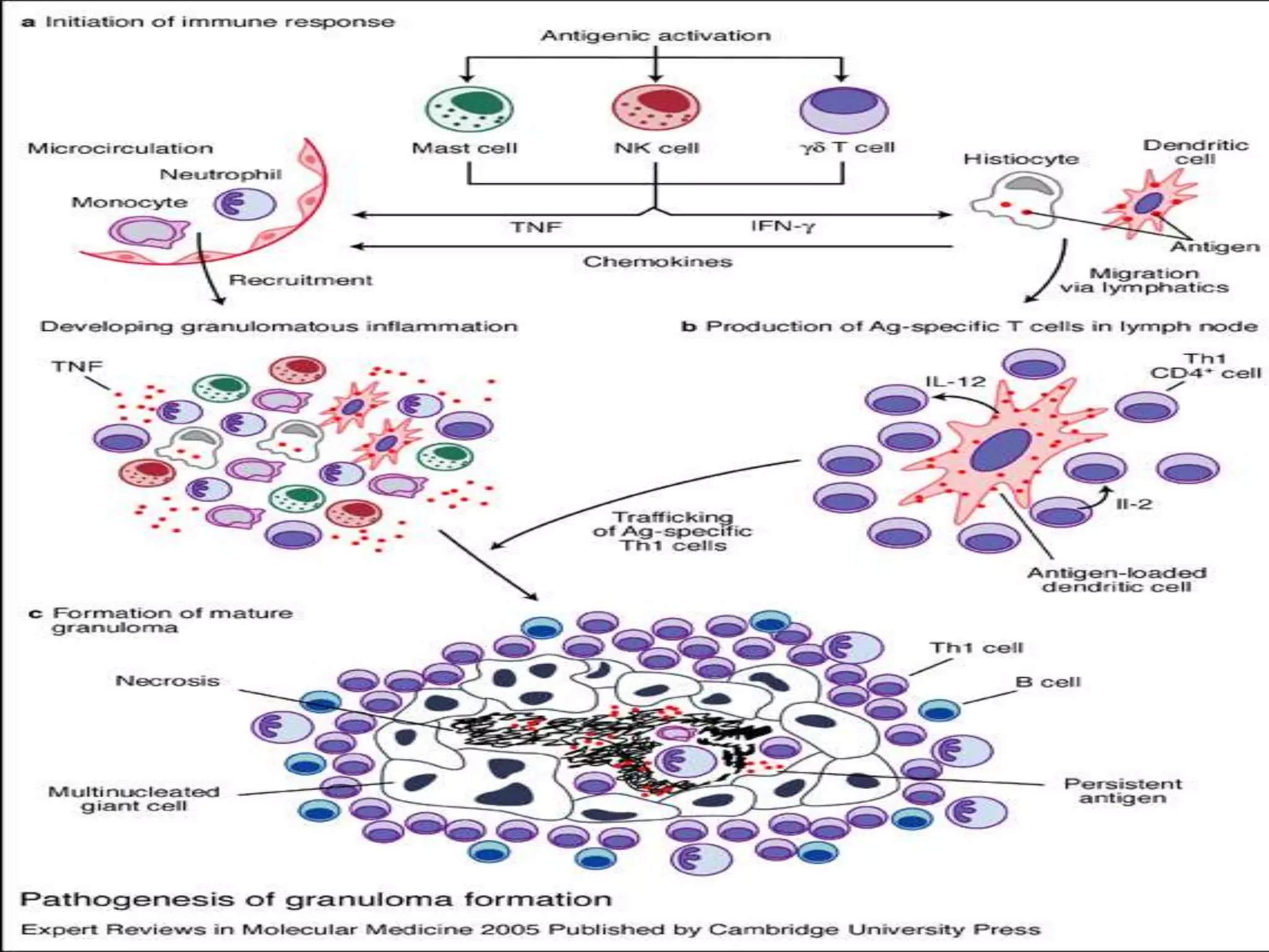 Systemic effects of acute inflammation and granuloma | PPTX