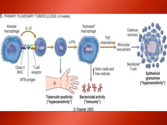 Systemic effects of acute inflammation and granuloma | PPTX | Blood ...