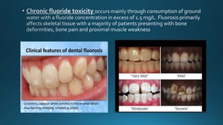 Systemic fluoride seminar by third yr students.pptx