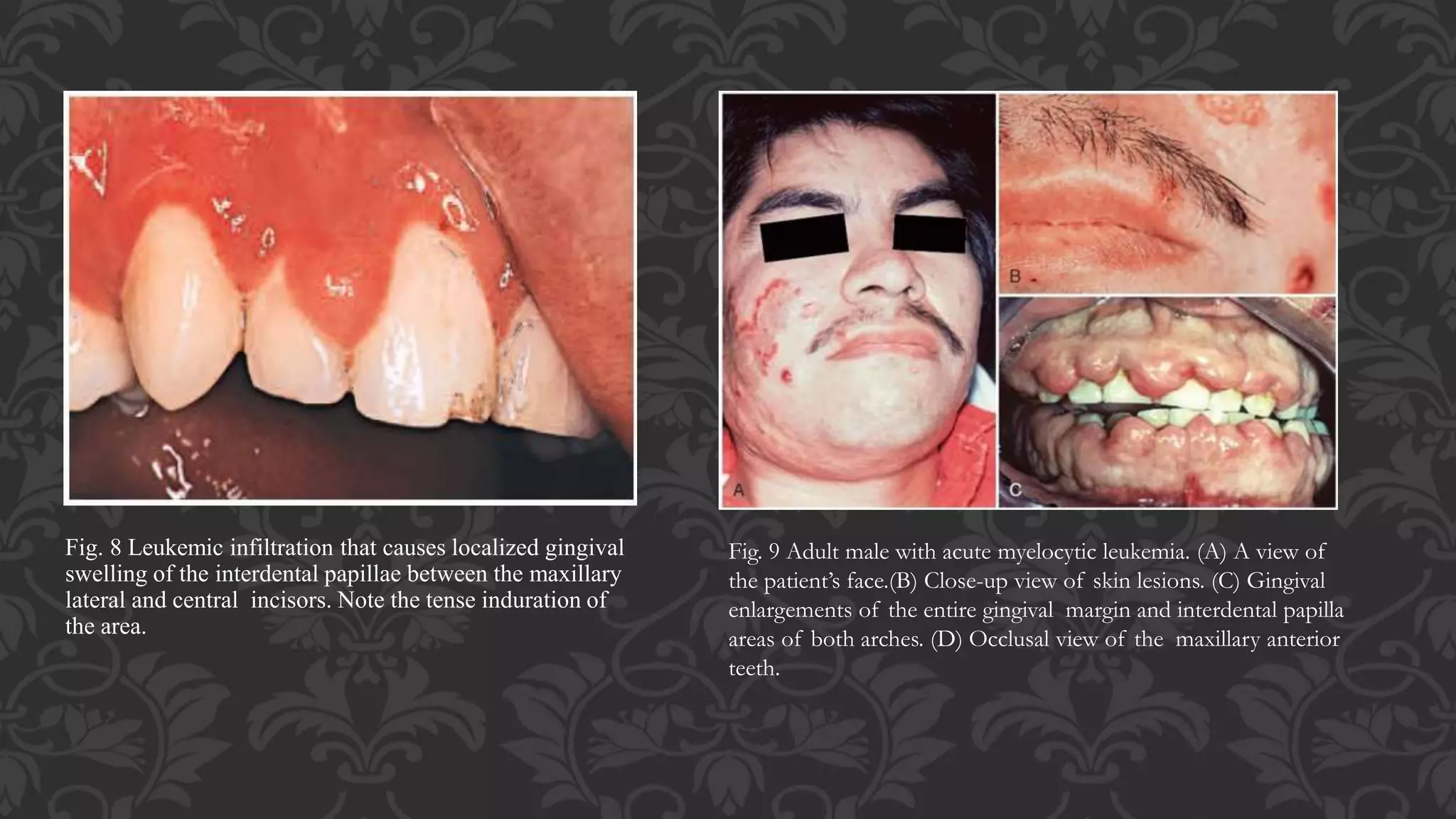 Systemic Health and Periodontal Disease.pptx