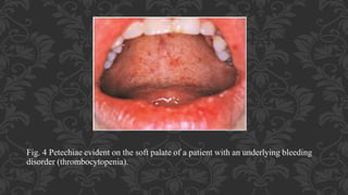 Systemic Health and Periodontal Disease.pptx