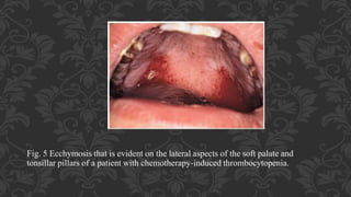 Systemic Health and Periodontal Disease.pptx