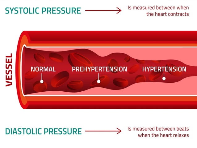 SYSTEMIC HYPERTENSION .pptx