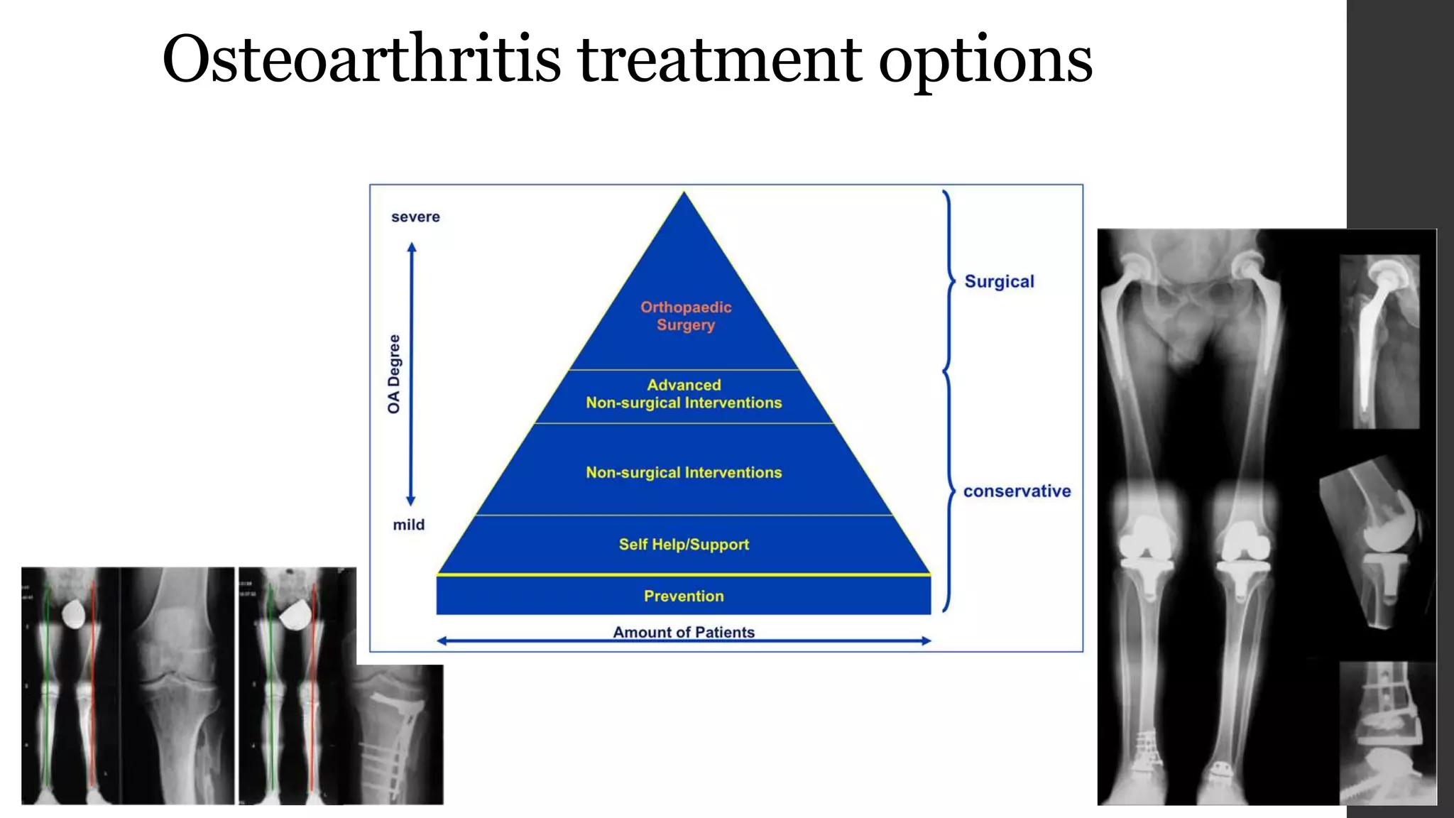 Systemic inflamatory rheumatoid arthritis & non inflamatory ...