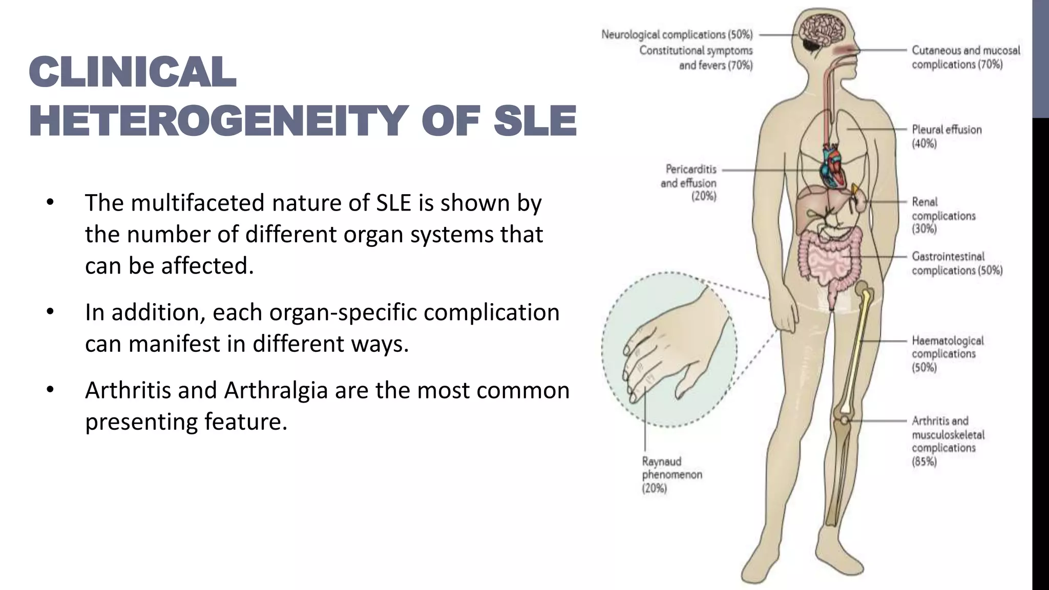 Systemic lupus erythematosis | PPTX
