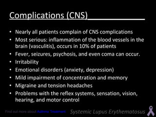 Systemic Lupus Erythematosus | PPT