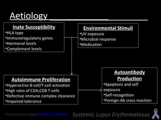 Systemic Lupus Erythematosus | PPT