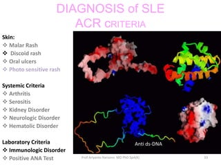Systemic lupus erythematosus | PPTX