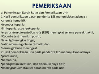 Systemic lupus erythematosus | PPT