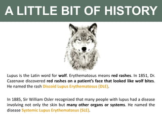 Systemic lupus erythematosus (SLE) | PPTX