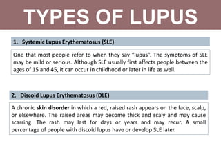 Systemic lupus erythematosus (SLE) | PPTX