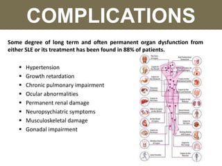 Systemic lupus erythematosus (SLE) | PPT