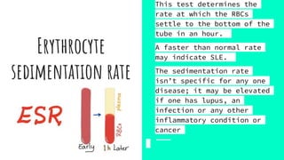 Systemic lupus erythematosus (SLE) | PPT