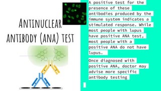 Systemic lupus erythematosus (SLE) | PPT