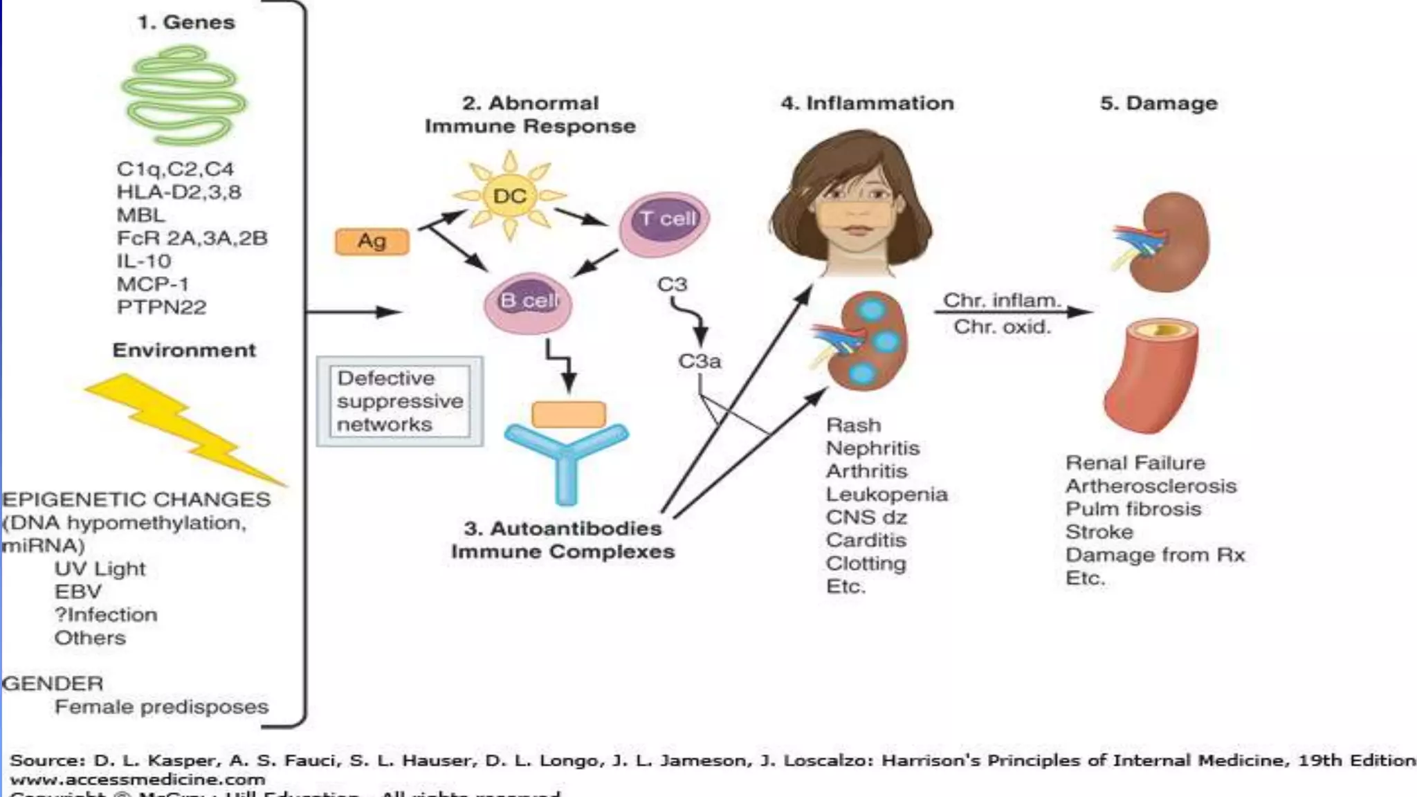 Systemic lupus erythematosus by dr. mohammad abass reshi | PPT