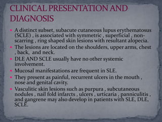 Systemic lupus erythematosus | PPTX