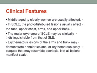 Systemic lupus erythematosus | PPTX
