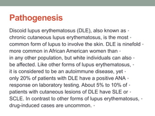 Systemic lupus erythematosus | PPTX