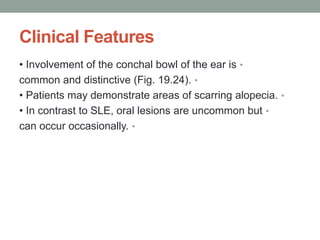 Systemic lupus erythematosus | PPTX