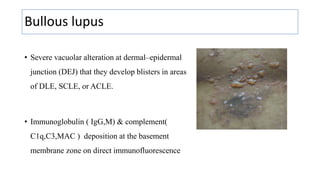 Systemic lupus erythematosus.pptx
