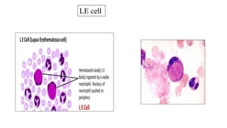 Systemic lupus erythematosus.pptx