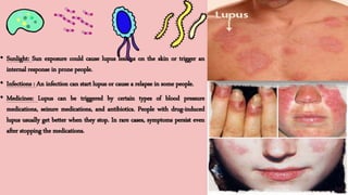 Systemic lupus erythematosus | PPTX