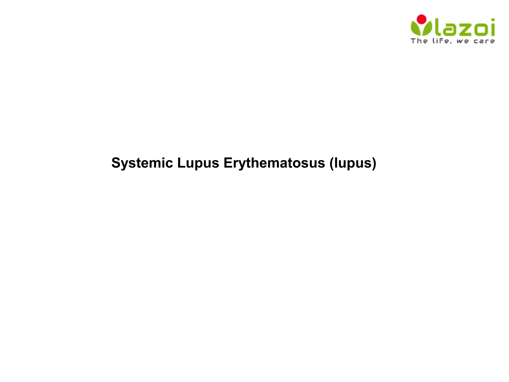 Systemic lupus erythematosus (lupus) | PPT
