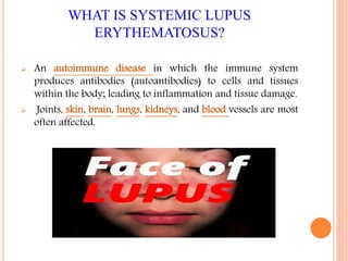 Systemic lupus erythematosus (lupus): Disease of the immune system | PPTX
