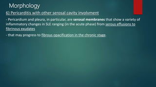 Systemic lupus erythematosus - Dr Pranav | PPTX