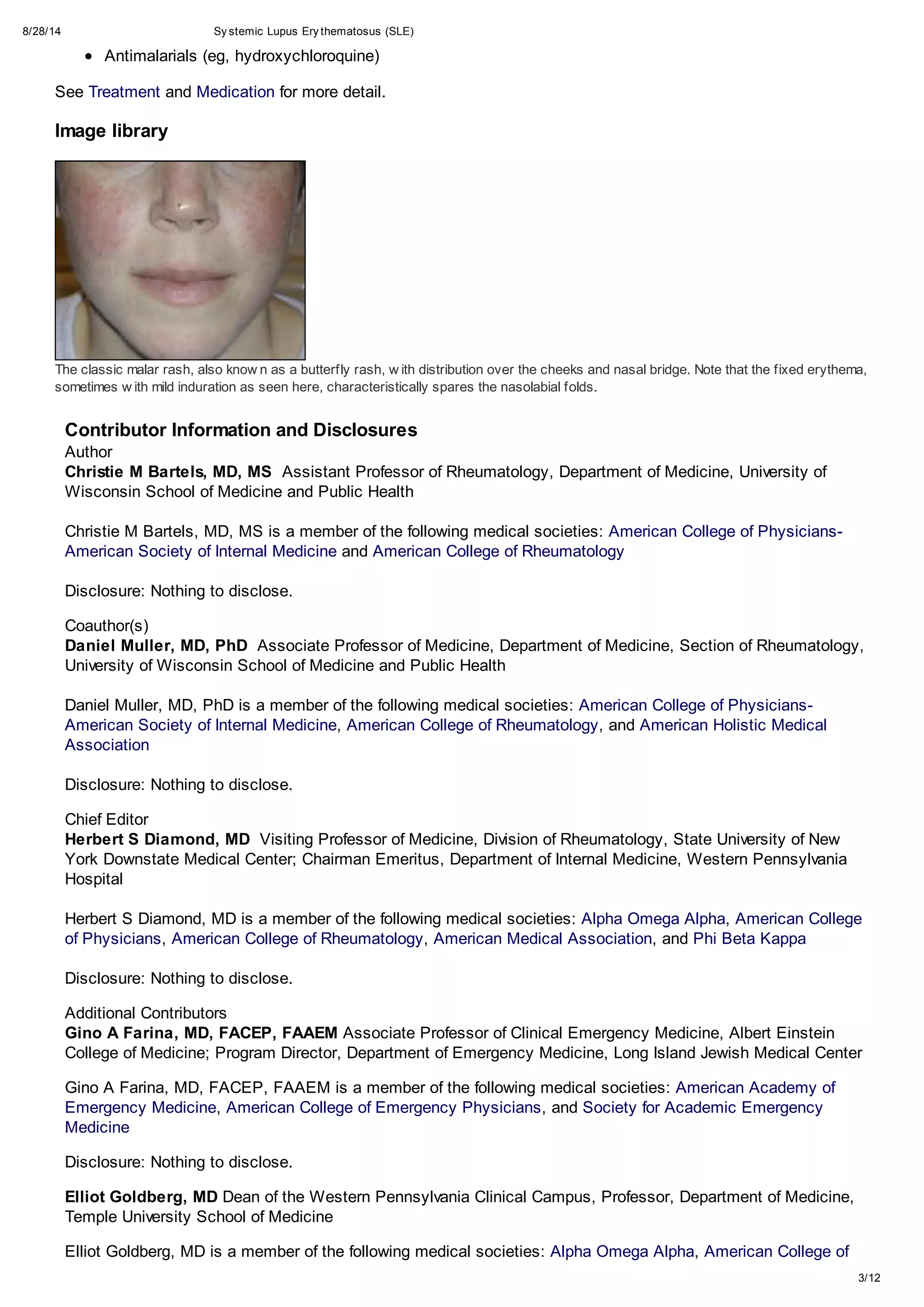 Systemic lupus erythematosus (sle) | PDF